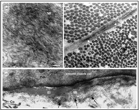 Vertebrate And Invertebrate Fibrillin Rich Microfibrils A Ultrathin Download Scientific