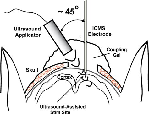 Figure 1 From Ultrasonically Assisted Intracortical Microstimulation Of