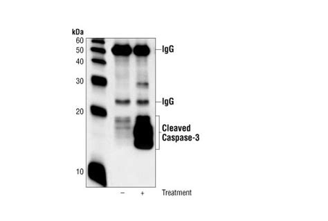 Cst Apoptosis Marker Cleaved Caspase 3 Asp175 Western Detection Kit