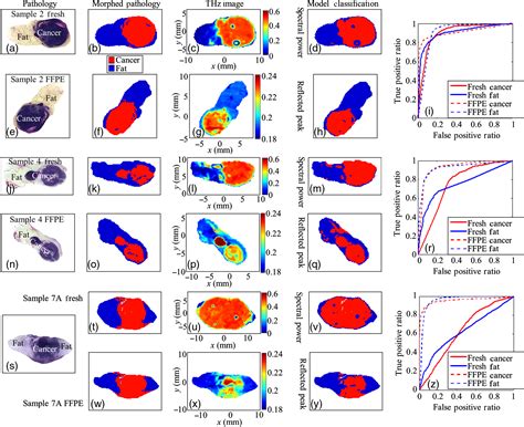 Pulsed Terahertz Imaging Of Breast Cancer In Freshly Excised Murine Tumors