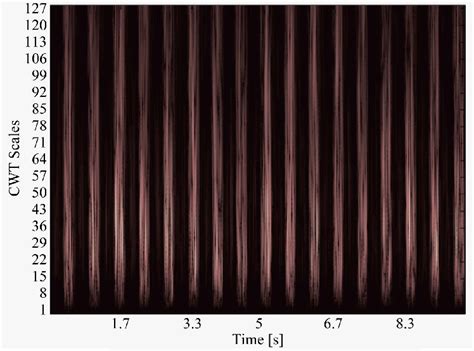 Cwt Coefficients Of The 10 Sec Emg Example Signal Download Scientific Diagram