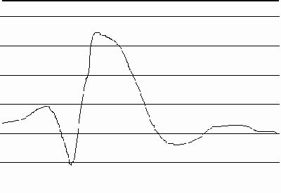 An Introduction To EEG