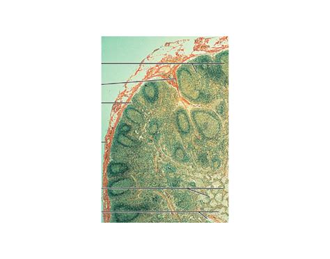 Histology Of Lymph Node — Printable Worksheet