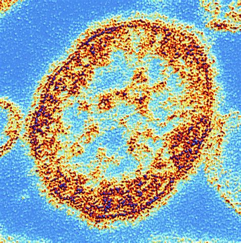 Measles Virus Under Microscope