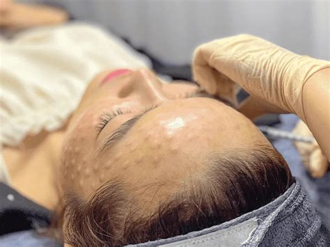 Meso Vip Rebi Beauty Spa