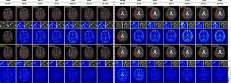Comparison Of Differences Between The Sr Images Derived From The