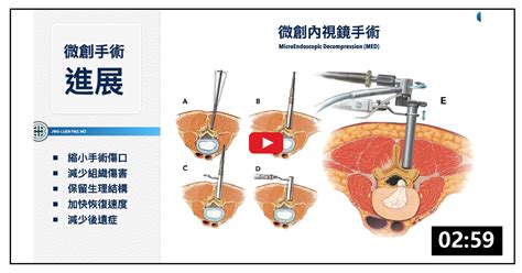 【新創幫vol073】dkabio健康風險評估系統、創新雙通道脊椎微創內視鏡手術、精準客觀化脊髓損傷幹細胞治療系統｜國家新創獎