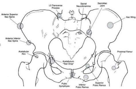 Pelvis Fractures Pediatric Pediatrics Orthobullets