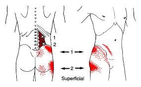 Quadratus Lumborum Why It Hurts And How To Fix It PhysioPrescription
