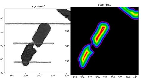 Skimage Segment Overlapping Regions Graphic Music Notation Image