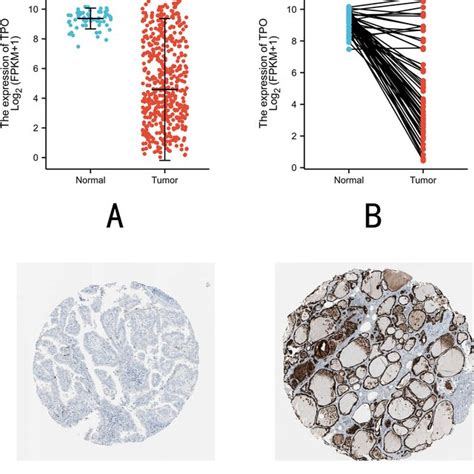 Expression Levels Of Tpo In Thyroid Cancer And Normal Thyroid Tissues Download Scientific
