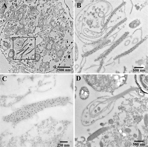 Electron Micrographs Of Ultrathin Sectioned Cells Of Oxyrrhis Marina
