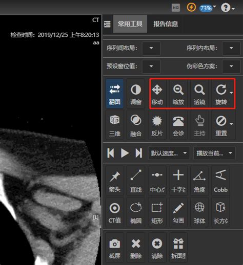 微云影像dicom医学影像浏览器 影像云、云pacs阅片、dicom、h5 viewer、html5 dicom viewer、web pacs、医学影像浏览器、云电子胶片阅片
