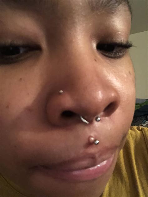 Medusa Piercing Scar Tissue
