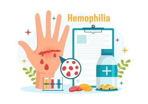 hemofilia vector ilustración con médico examinando lesionado rodilla o articulación y sangre