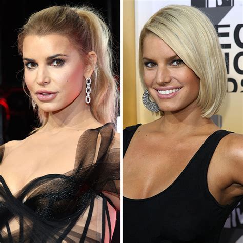Jessica Simpson Teeth Before And After