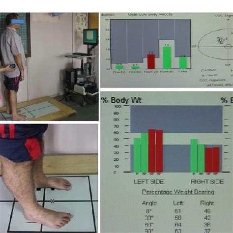 Functional Ambulation Categories Adapted From Perry J Et Al 1995 Download Scientific Diagram