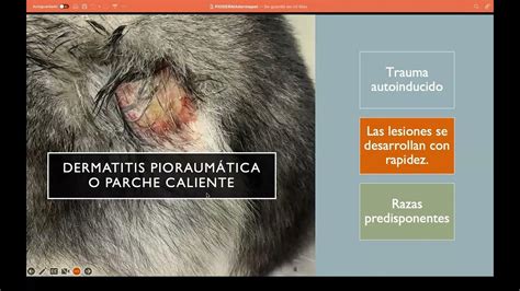 Pioderma Youtube Pioderma Youtube