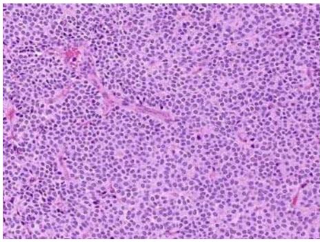 Endo Clinical Genetics And Pathology Flashcards Quizlet