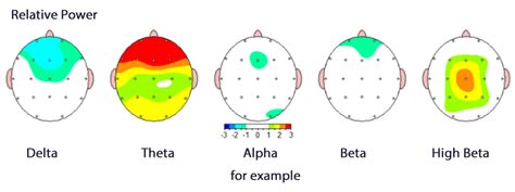 Quantitative Eeg Analysis Ifen Neurofeedback Blog