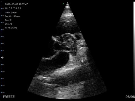 Linear Convex Phased Array In Handheld USB Ultrasound Double Probes Wireless Color Doppler