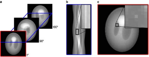 Principle Of Ring Artifact Correction With Modified Sinogram Processing