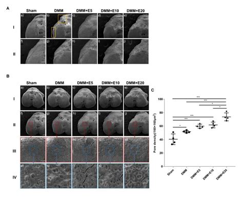 Scanning Electron Microscopy Sem Analysis Of Subchondral Bone A Download Scientific