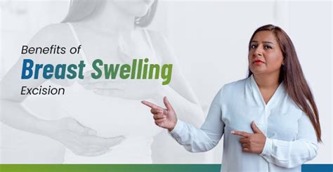Breast Swelling Excision Causes Procedures And Benefits Breast Swelling Excision Causes Procedures And Benefits