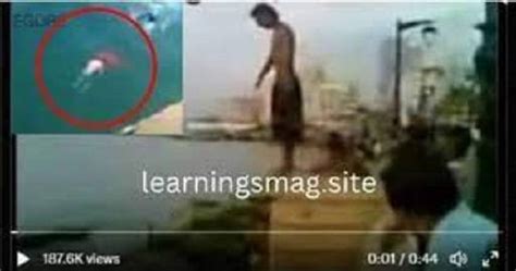 Split Face Diving Accident A Cautionary Tale