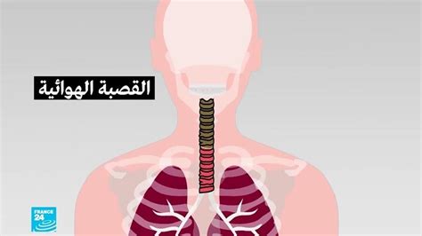 فريق طبي فرنسي ينجح في زرع القصبة الهوائية للمرة الأولى في العالم