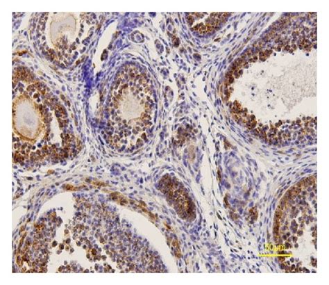 Detection Of Cx43 Expression Af Localization Of Cx43 In The