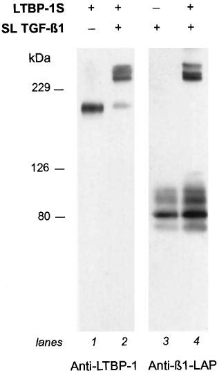 Production Of Small Latent Tgf 1 Ltbp 1s And Large Latent Complex By Download Scientific