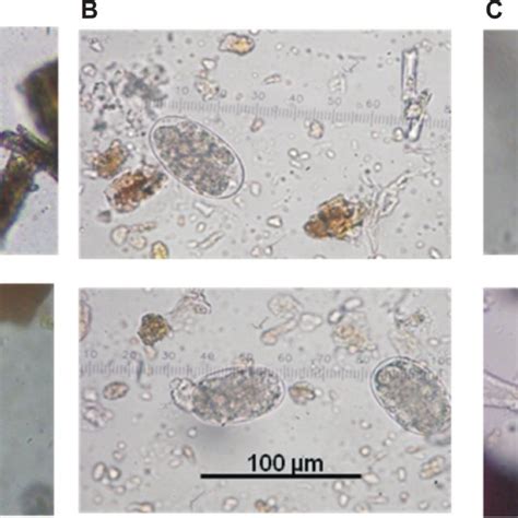 Pdf Human Infection By Trichostrongylus Spp In Residents Of Urban Areas Of Salvador City