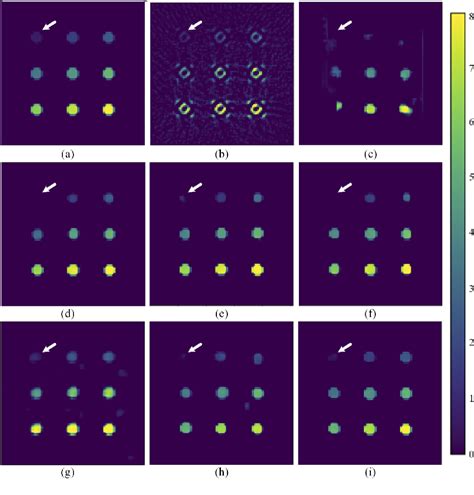 Figure 5 From End To End Res Unet Based Reconstruction Algorithm For