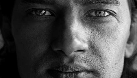 What Causes Big Pores On My Nose And Cheeks