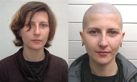 Before After Shaved Heads Pics Photo