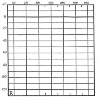 Need Help Reproducing Graph Audiogram With Log Axis With Very