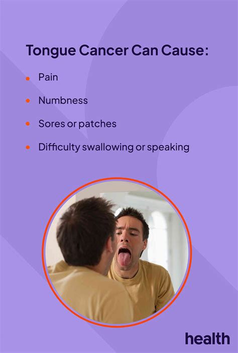 Tongue Cancer Signs And Symptoms