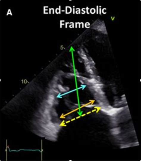 GC CVT Echo Visual Protocol