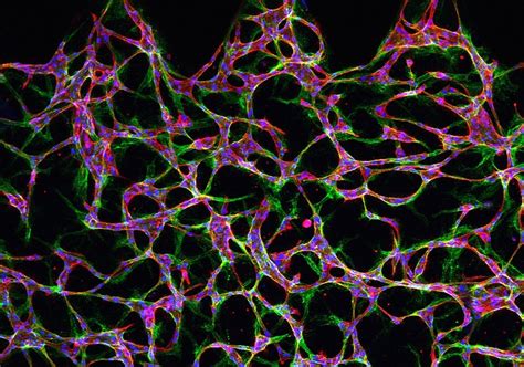 Tiny Tools Help Advance Medical Discoveries Mit News Massachusetts Institute Of Technology