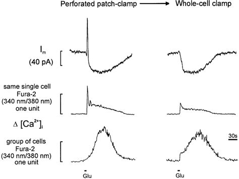 Simultaneous Recording Of Membrane Current And C A 2 I Using The