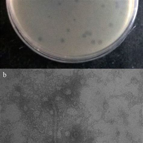 Bacteriophage Plaques Observed On The Surface Of The Agar Plates