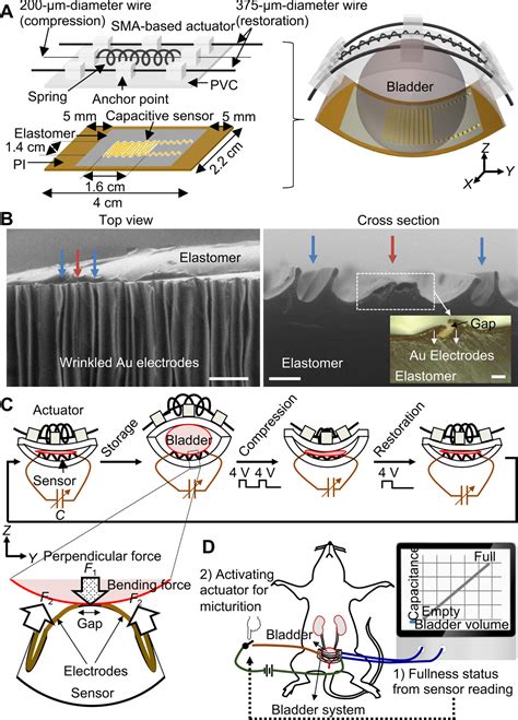 Soft Sensors For A Sensing Actuation System With High Bladder Voiding