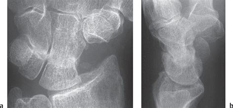 13 Postsurgical Radiography Radiology Key
