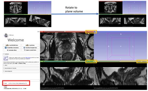 Get Slicewidget Slicenode Coordinate From Ras Or Ijk Development 3d Slicer Community