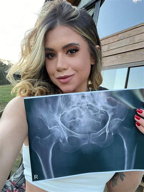 Haters Say My Perfect Butt Is Fake X Rays Prove Its Real