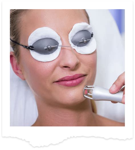 Best Clinic For Q Switched Laser Treatment In Bangalore