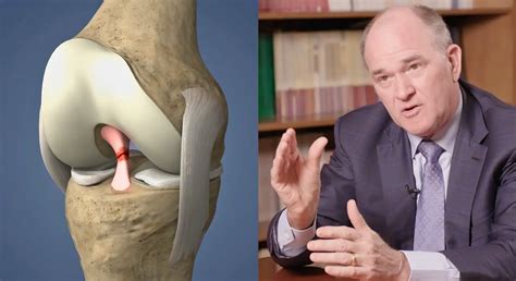 Why Females Tear Their ACL X More Than Males UnderstandOrtho