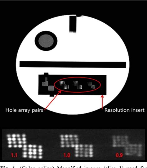 Figure 1 From Comparison Of A Zero Filling Interpolation With A Real Matrix Size At 15 Tesla