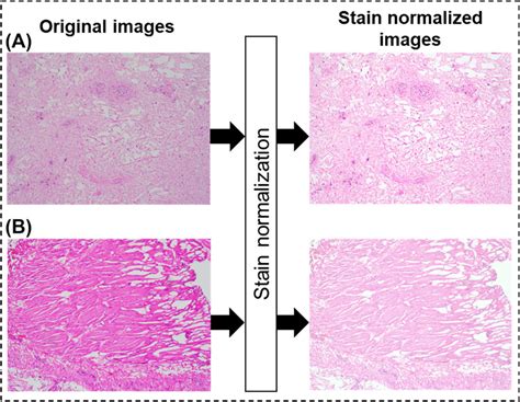 Effect Of Reinhard Stain Normalization On Hande Stained Histopathological Download Scientific